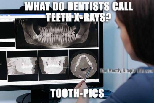 71 Best Dentist Jokes & Memes That Won't Hurt - The (mostly) Simple Life